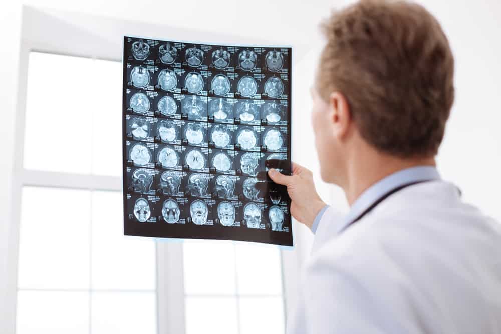 Neurochirurgien Avantages Et Inconvenients