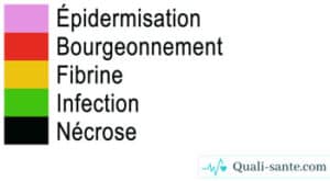 Types de plaies | Liste, causes et traitements